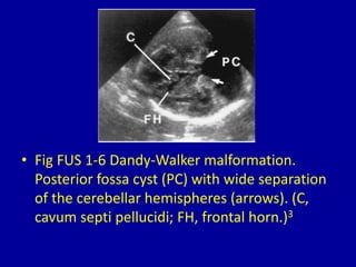 1 ultrasound diagnosis of fetal anomalies | PPTX