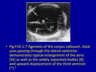 1 ultrasound diagnosis of fetal anomalies | PPTX
