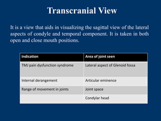 1_updated_temporomandibularjointimaging-180225163412 2.pdf