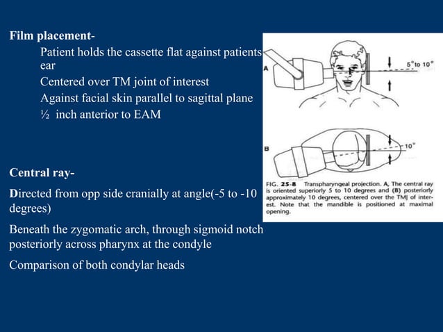 1_updated_temporomandibularjointimaging-180225163412 2.pdf