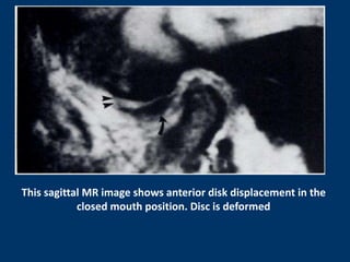 1_updated_temporomandibularjointimaging-180225163412 2.pdf