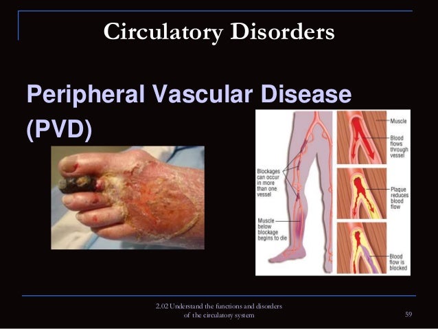 2.02 understand the_functions_and_disorders_of_the_circulatory_system