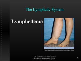 Functions and Disorders of the Lymphatic System | PPT