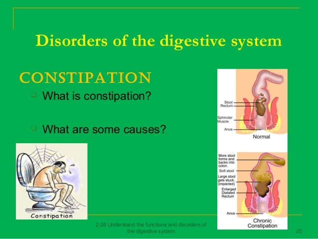 What Causes Digestive Problems