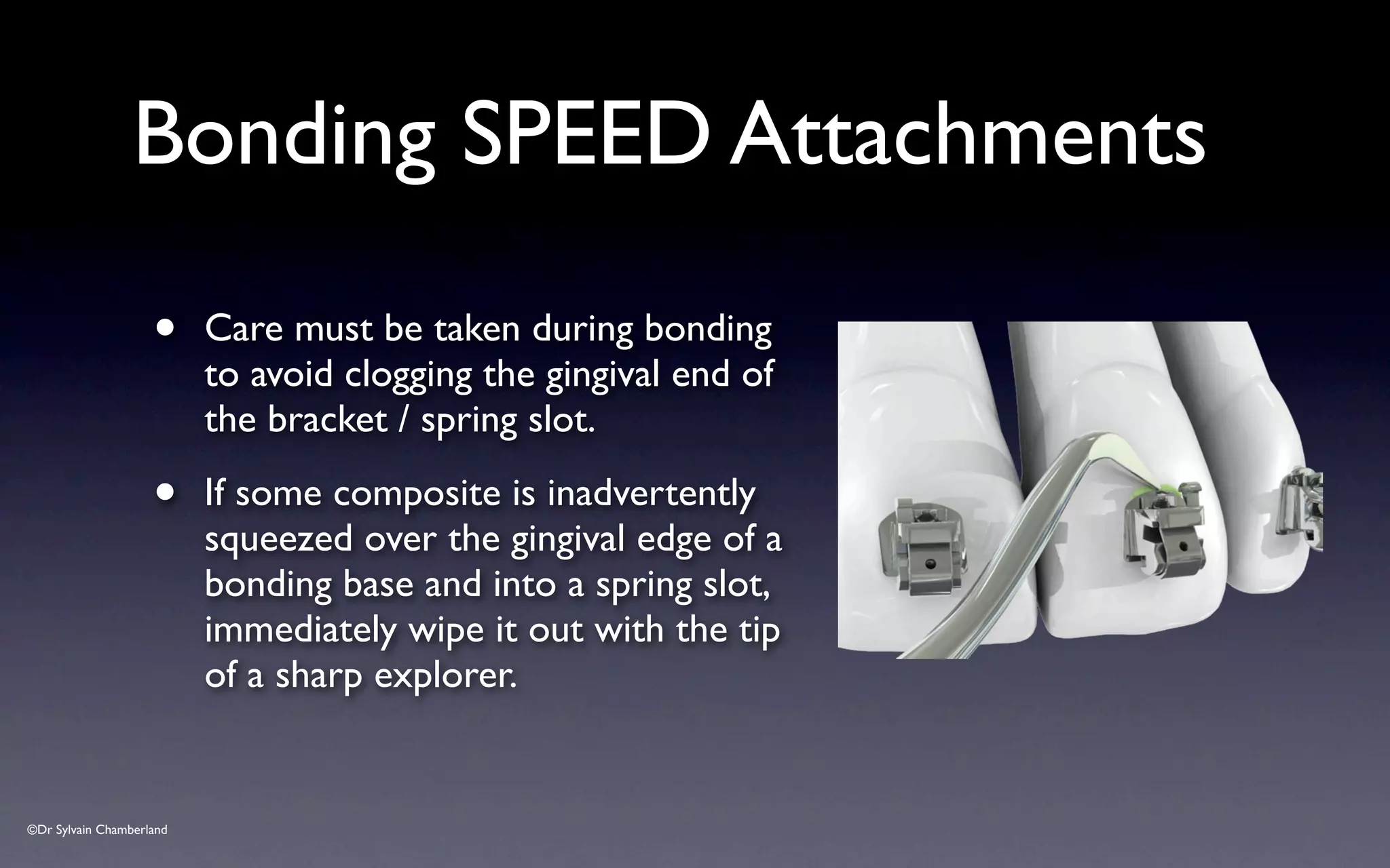 SPEED Bracket Placement Guide v2012 | KEY