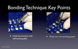 SPEED Bracket Placement Guide v2012 | KEY