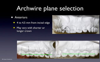 SPEED Bracket Placement Guide v2012 | KEY