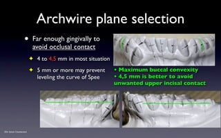 SPEED Bracket Placement Guide v2012 | KEY