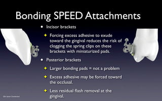 SPEED Bracket Placement Guide v2012 | KEY