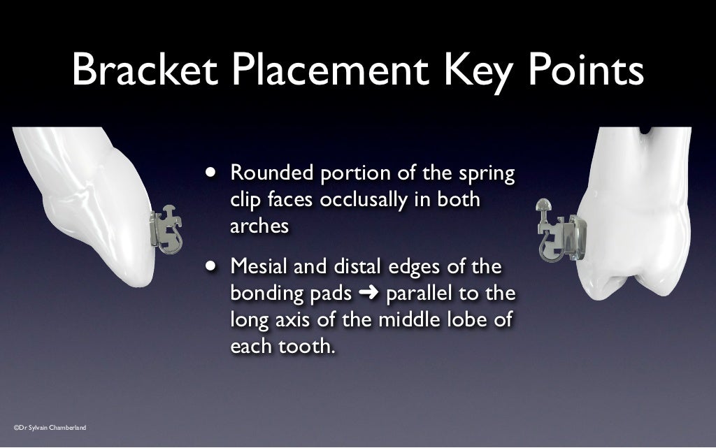 SPEED Bracket Placement Guide v2012
