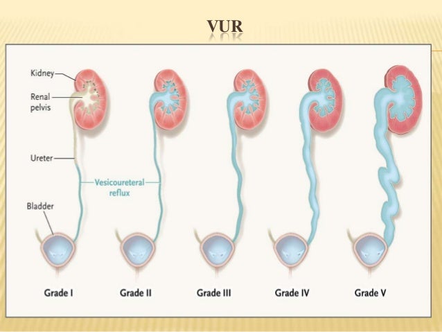 2-1. CAKUT. Svetlana Paunova (eng)