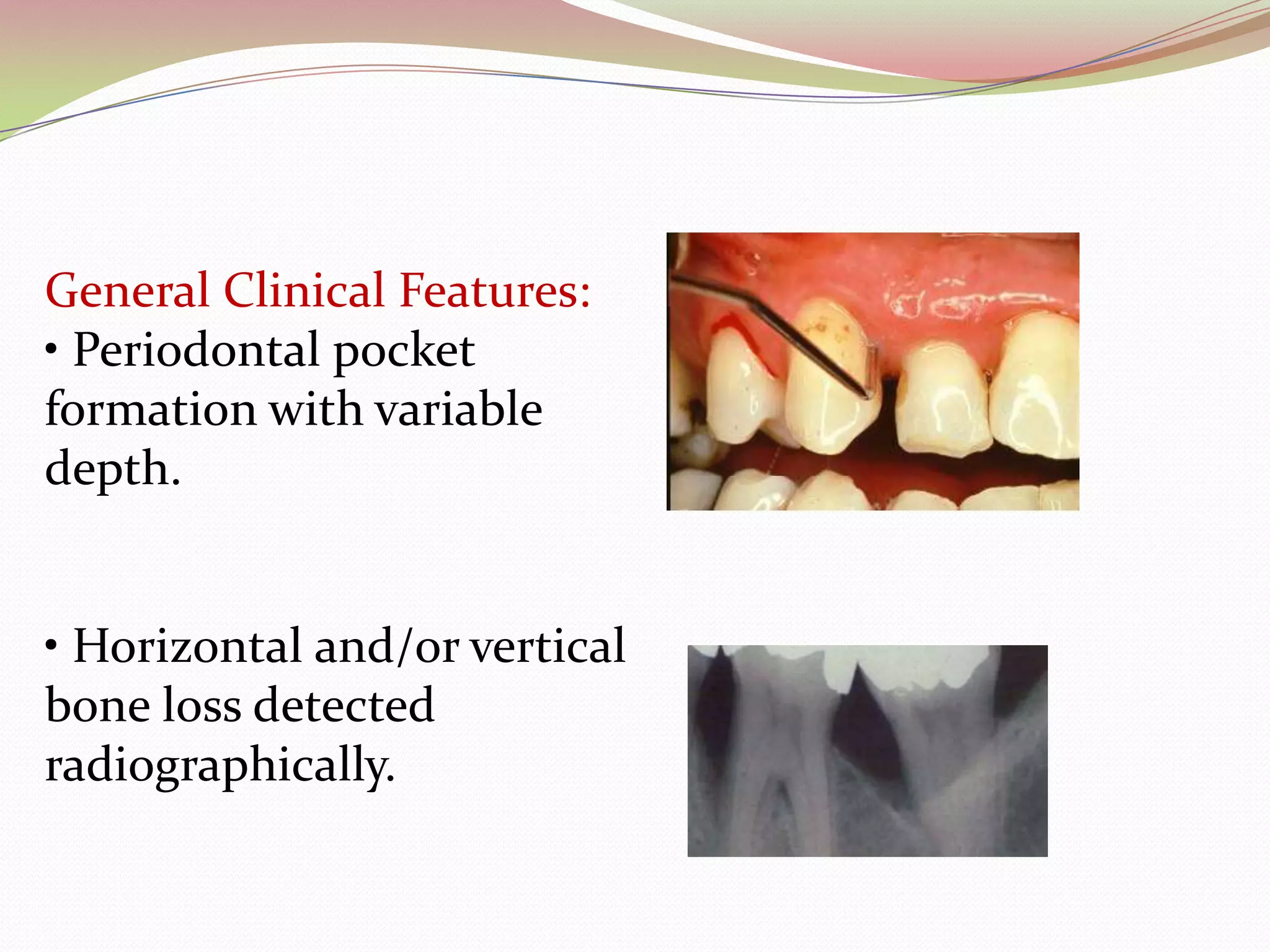 Introduction to Periodontics | PPTX