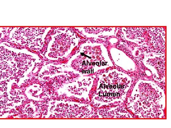 Compare histopathology