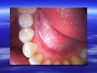 ΣΤΟΓΙΑΝΝΗΣ ΠΕΡΙΣΤΑΤΙΚΟ 2 | PPT