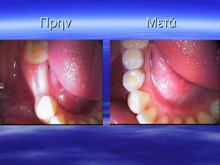 ΣΤΟΓΙΑΝΝΗΣ ΠΕΡΙΣΤΑΤΙΚΟ 2 | PPT