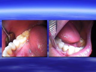 ΣΤΟΓΙΑΝΝΗΣ ΠΕΡΙΣΤΑΤΙΚΟ 2 | PPT