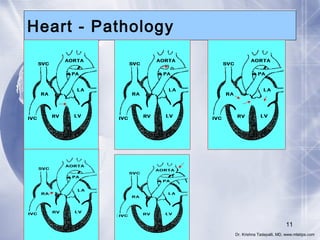 2. heart pathology; congenital disorders | PPT