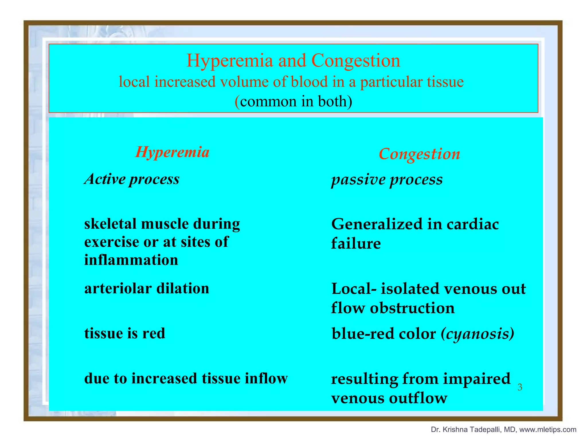 2. hyperemia and congestion; hemodynamic disorders | PPT