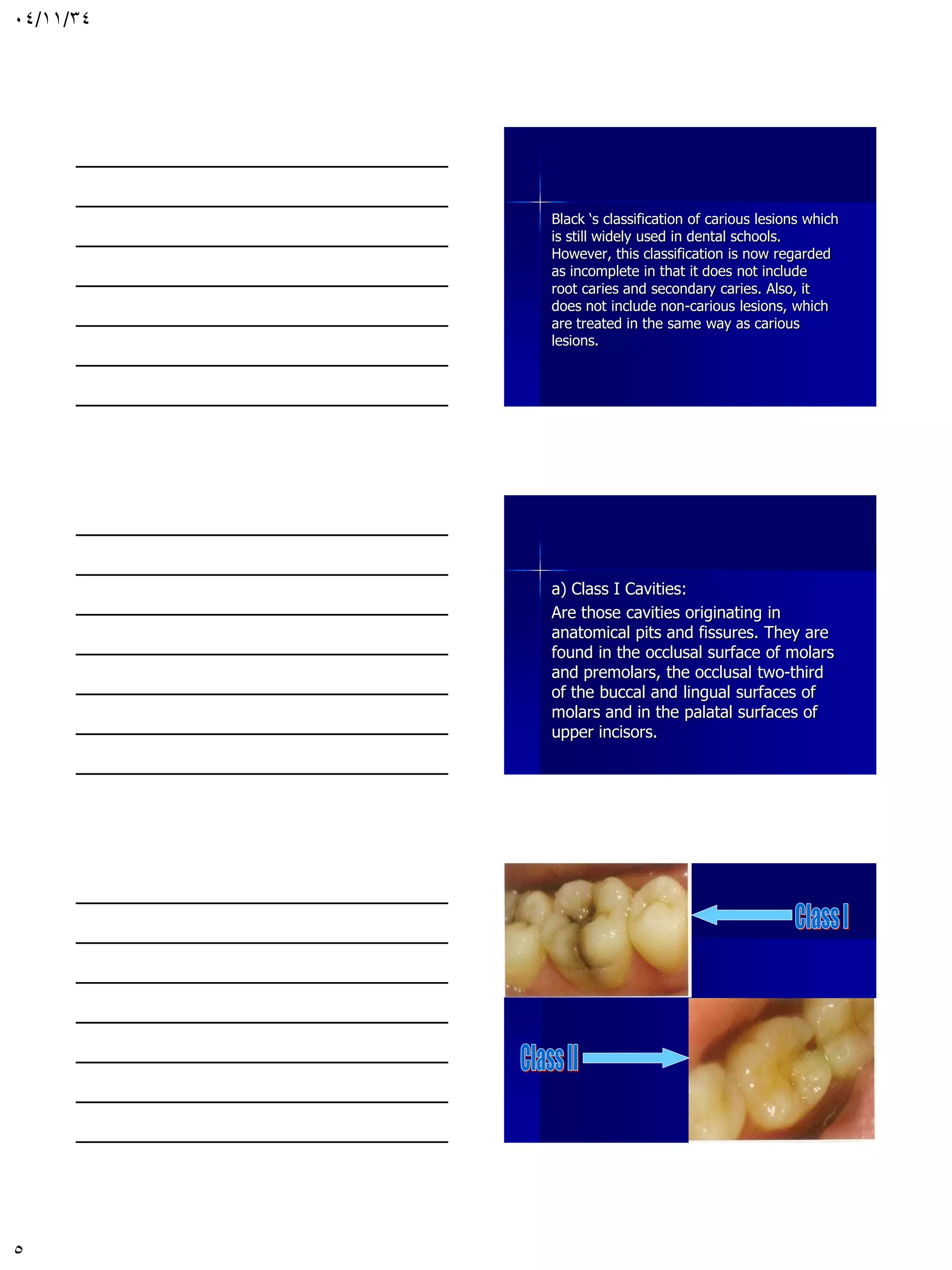 cavity classification and nomenclature (3) | PDF
