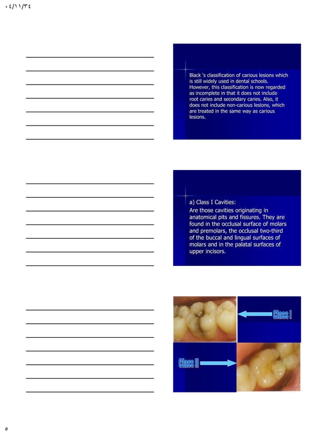 cavity classification and nomenclature (3) | PDF | Dental Health ...