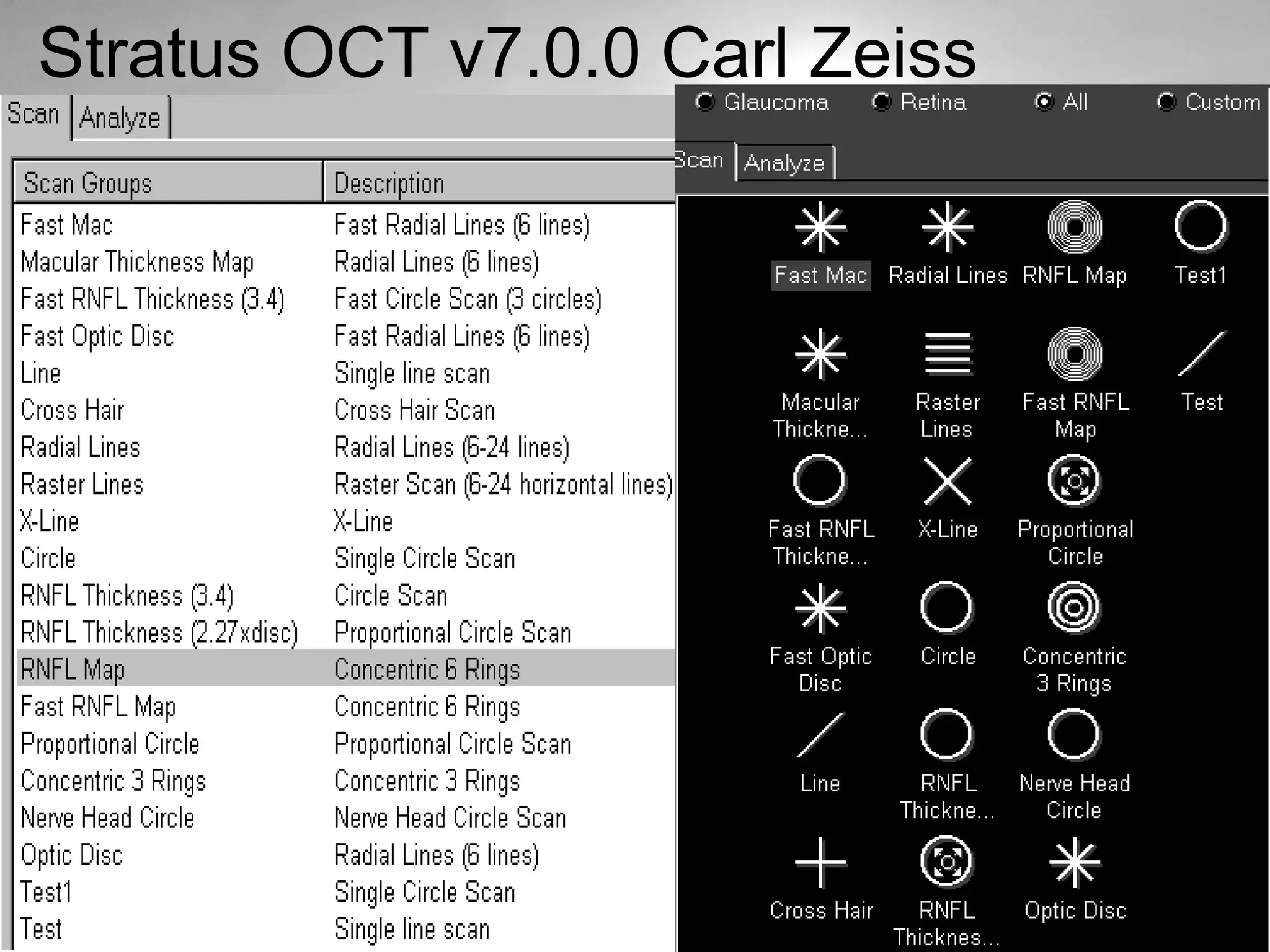 OCT for glaucoma + HRTclub2013 | PPT