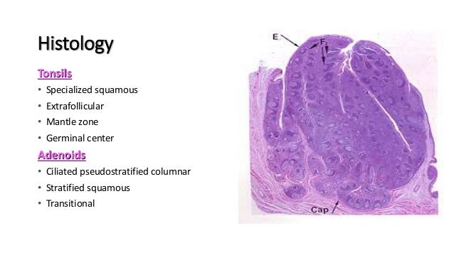 2. adenoid enlargement