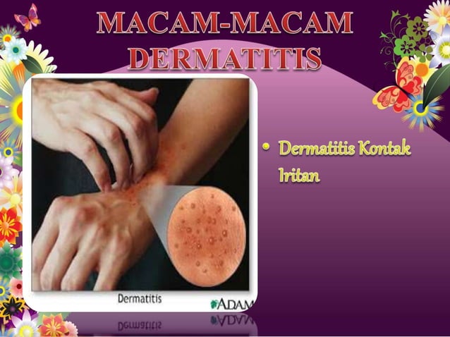 2. dermatosis | PPTX