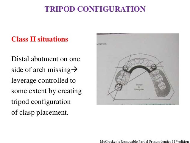 2 Principles Of Designing Rpd With Special Emphsis On Support And Pe…
