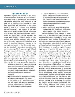 Immediate Implant Placement | PDF