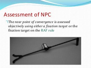 2.0 Convergence Insufficiency | PPTX