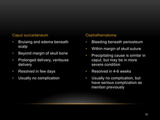 Cephalohematoma Vs Caput Succedaneum