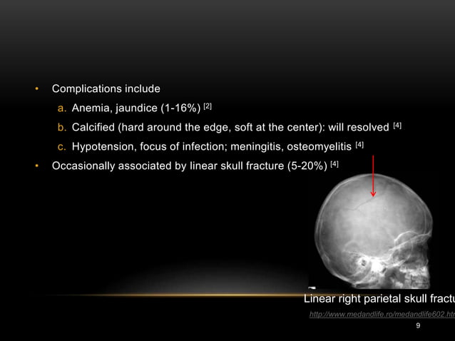 caput, cepahlhematoma & sah | PPTX | Pregnancy | Reproductive Health