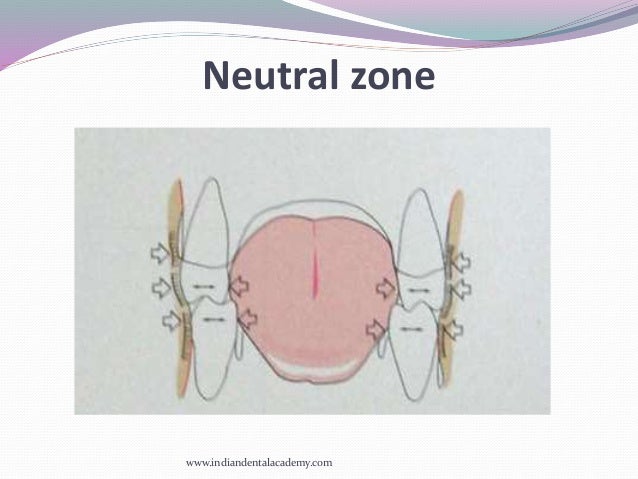 full mouth rehabilitation / academy general dentistry