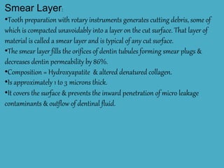 2. speeds in dentistry | PPTX