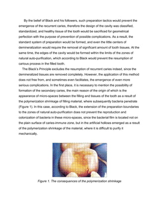 New Classification of Black’s Cavities Localization Part 1 | DOCX