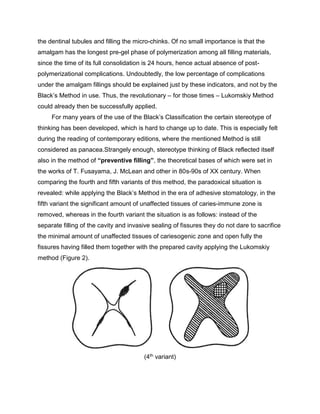 New Classification of Black’s Cavities Localization Part 1 | DOCX