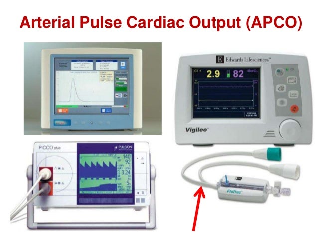 less invasive hemodynamic monitoring