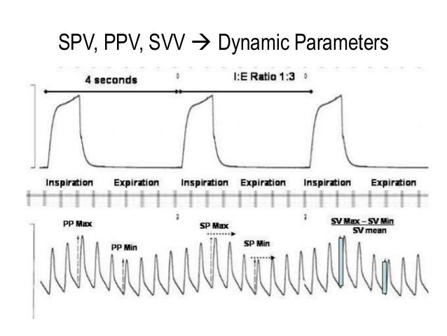 less invasive hemodynamic monitoring