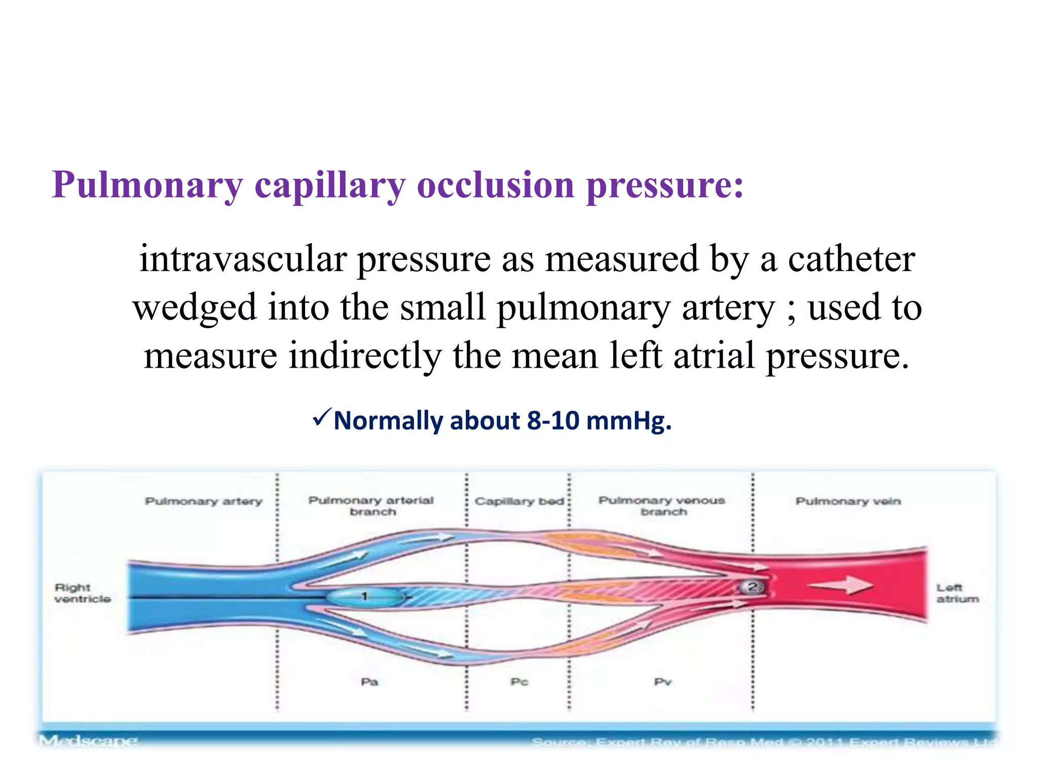 The CVP in hypovolemic shock. | PPTX