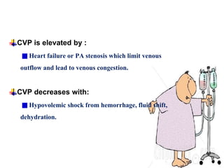 The CVP in hypovolemic shock. | PPTX