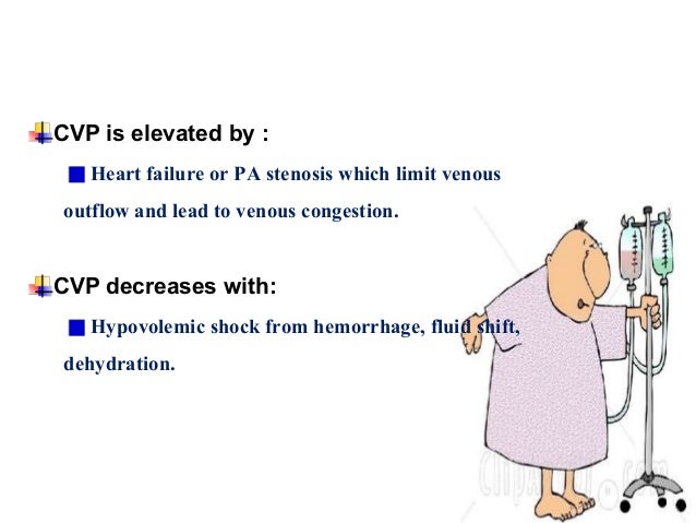 The CVP in hypovolemic shock.
