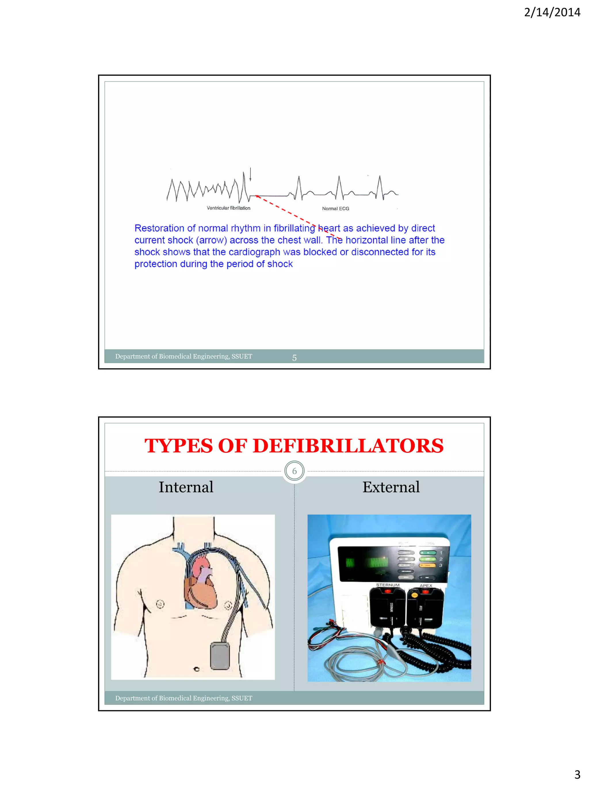 2. defibrillators | PDF