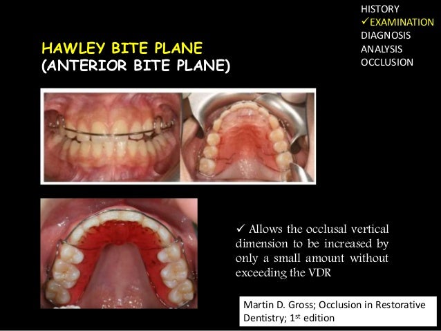 2.diagnosis restoration of worn dentition