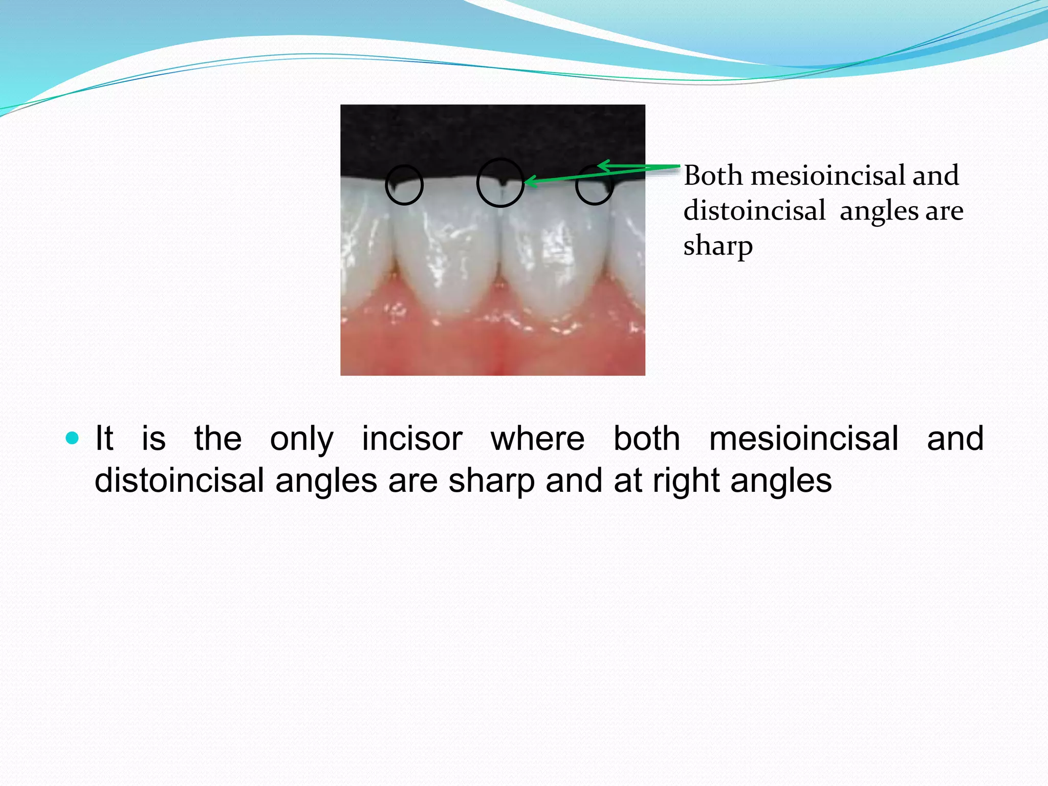 Permanent Mandibular Central Incisor | PPTX
