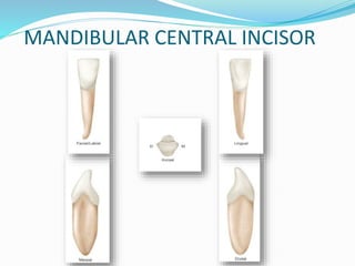 Mandibular Central Incisor