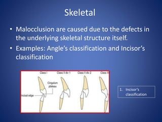 2.occlusion dental vs skeletal | PPTX