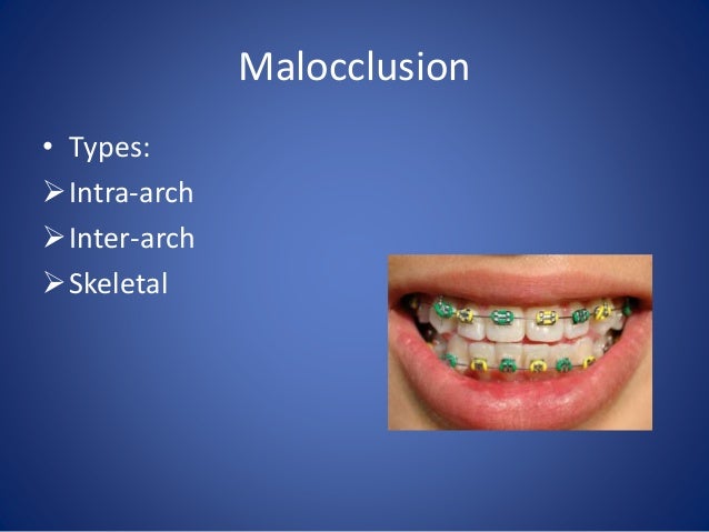 2.occlusion dental vs skeletal