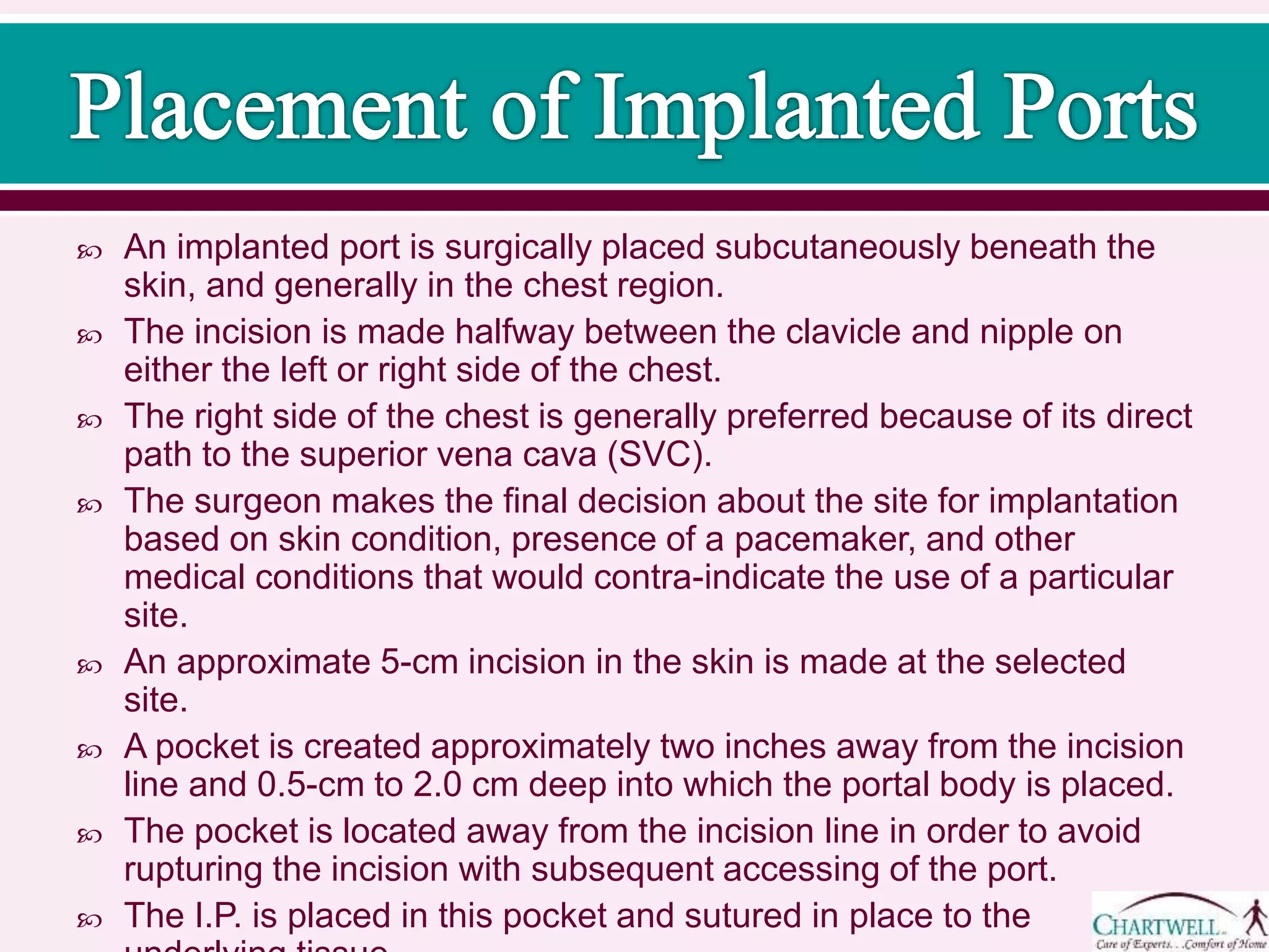 2. central venous access devices (cvads) | PPTX
