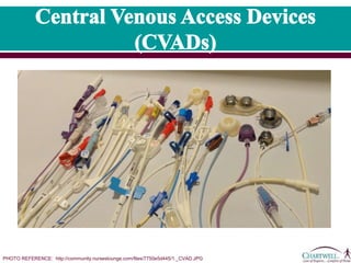 2. central venous access devices (cvads) | PPTX