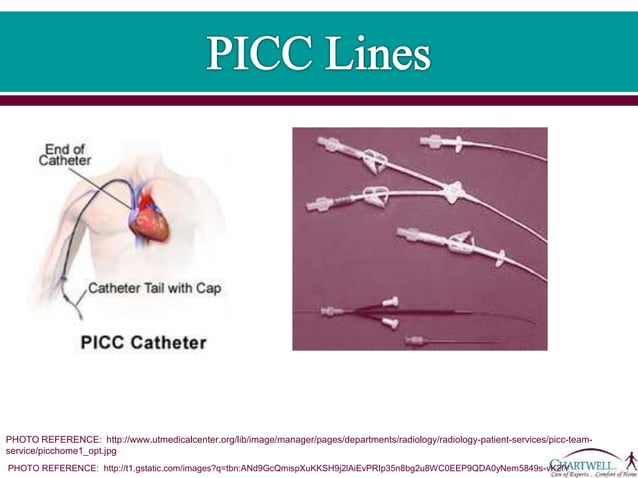 2. central venous access devices (cvads)